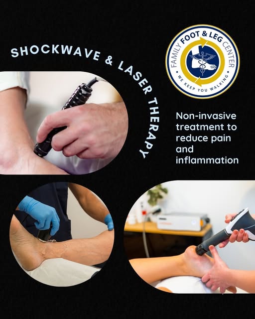 Shockwave & Laser Therapy: Step Into Relief at FFLC - NaplesPodiatrist