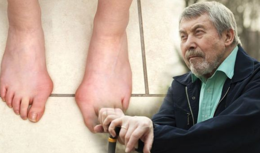 Foot and Ankle Issues in Parkinson's Disease - NaplesPodiatrist